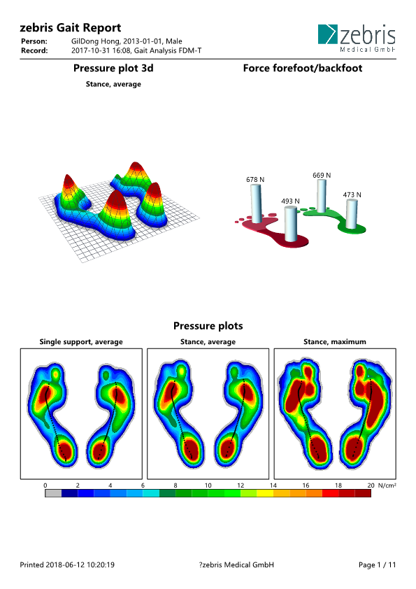 Zebris사의 FDM (판형 압력분포 측정 시스템)의 Gait Report(보행분석)을 소개합니다 : 네이버 블로그