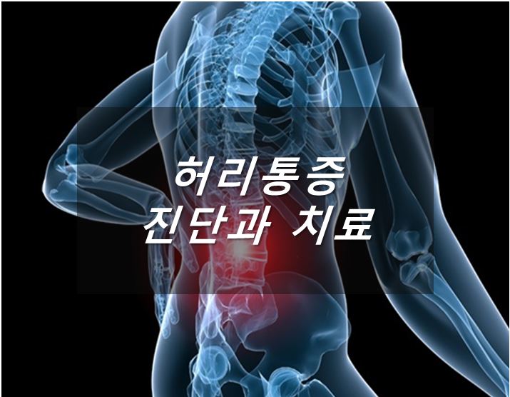 허리통증의 진단과 치료 네이버 블로그
