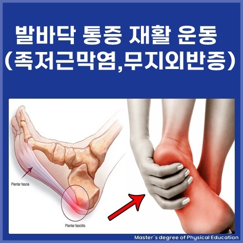 족저근막염 치료 방법 발바닥 통증 치료 족저 근막염 재활운동 평발 검사 방법족궁 검사 방법 네이버 블로그