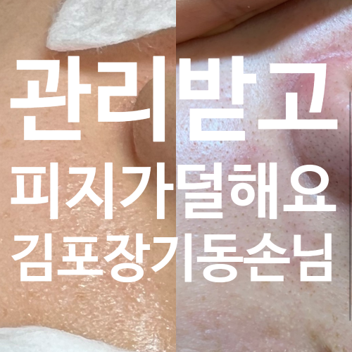 김포장기동피부관리손님이세요 장기동맛집 부천상동피부관리실 스킨엔 네이버 블로그