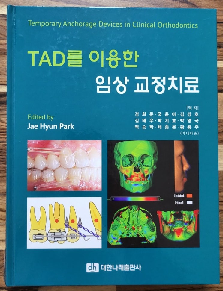 옥니 방지를 위해 알아야 것 : 전치부의 저항 중심 위치 『TAD를 이용한 임상 교정치료』 : 네이버 블로그