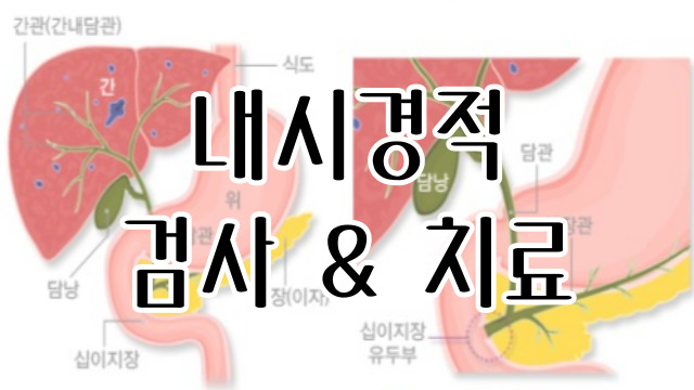 내시경적 검사치료 정리(ERCP, EST, ENBD, ERBD, PTBD) : 네이버 블로그