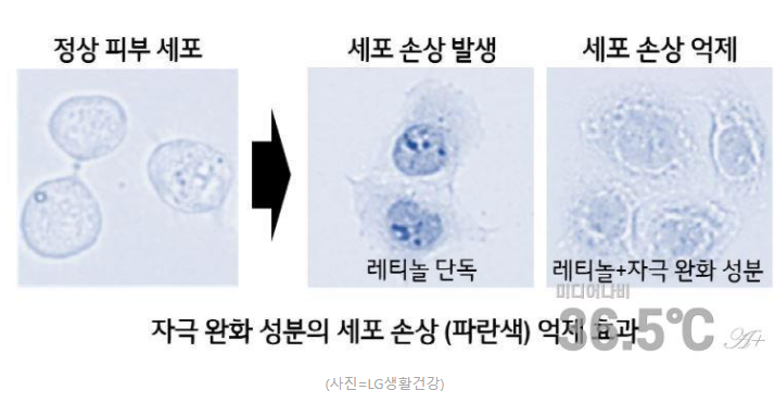 LG생활건강 "레티놀 피부자극 완화 성분 개발" : 네이버 블로그