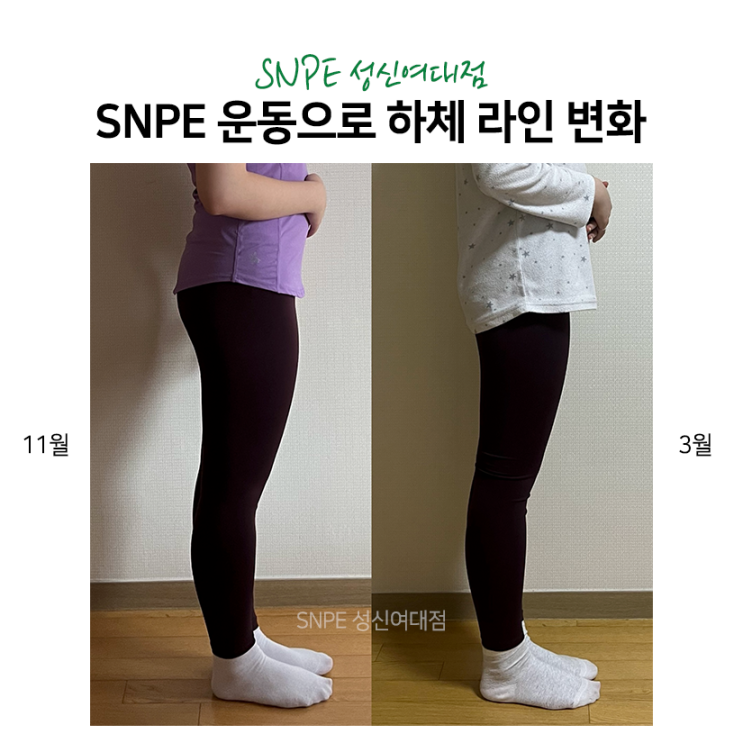 하체라인 변화 (with snpe 성신여대점) : 네이버 블로그