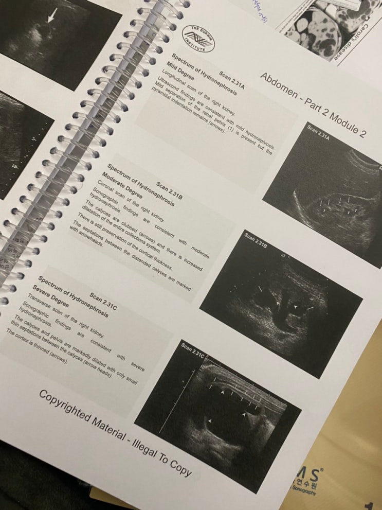 ARDMS AB 공부일지 : 네이버 블로그