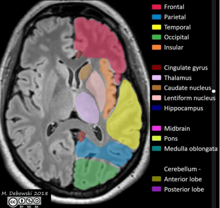 brain MRI anatomy : 네이버 블로그