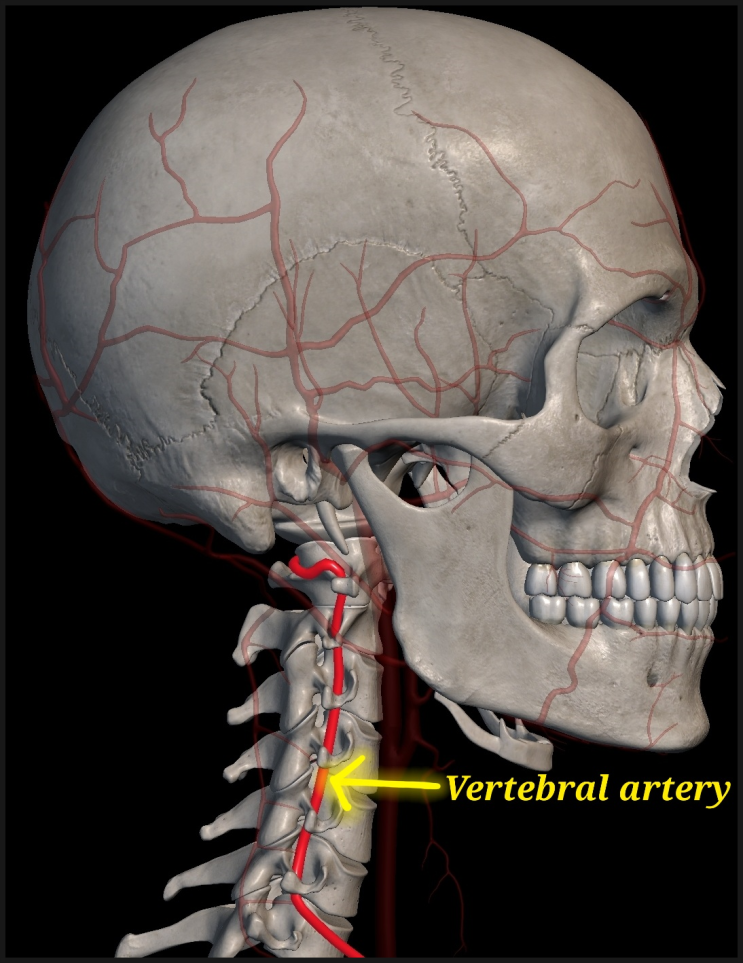 머리가 어지러워요 - 추골동맥 : 목뼈 사분위 검사(Cervical quadrant test) : 네이버 블로그