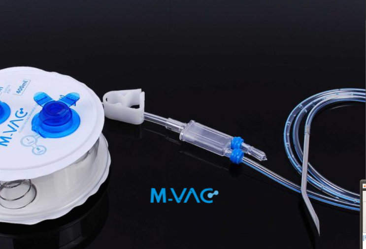 배액관의 종류 01.상처배액관-1)hemovac,jp(jackson-pratt) : 네이버 블로그