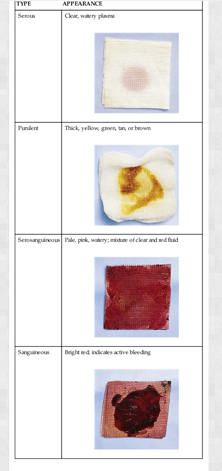 배액양상 serosa, sanguineous, serosanguineous : 네이버 블로그