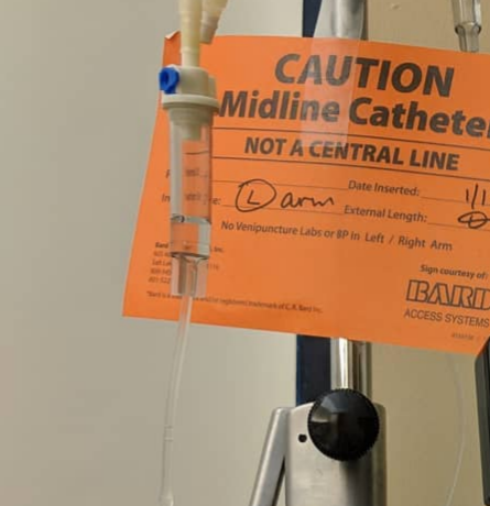 midline catheter : 네이버 블로그