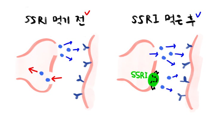 우울증 약 효과 원리 Ssri 플루옥세틴 푸록틴 프로작 연구논문 파헤치기 네이버 블로그