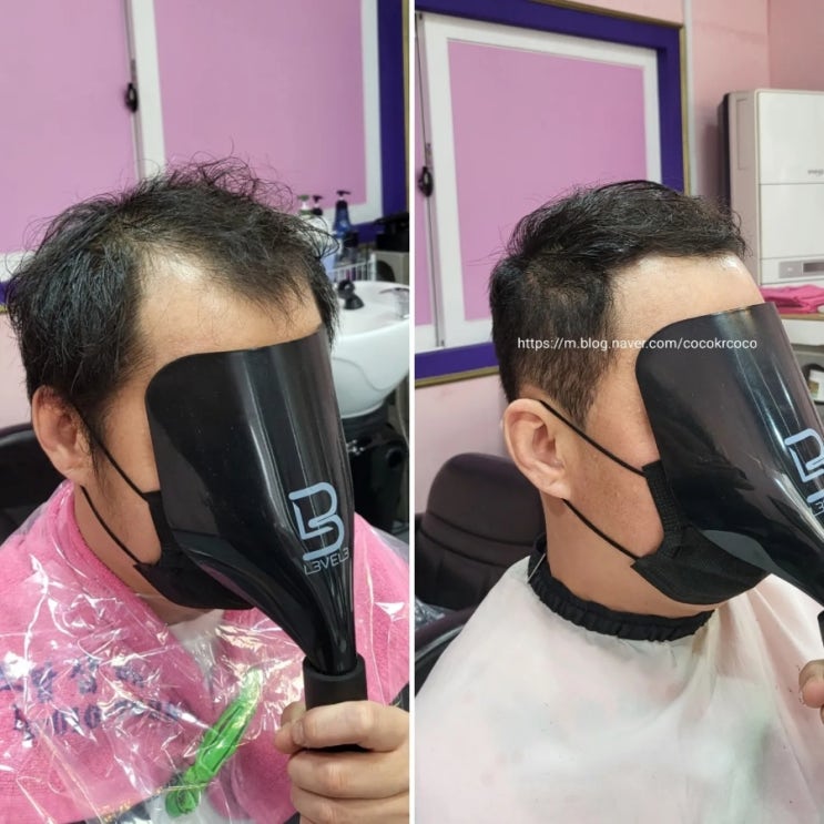 대구에서 평택증모전문 용이동미용실 헤어공감을 찾아 주신고객님의 헤어증모술 시술사례 입니다 네이버 블로그