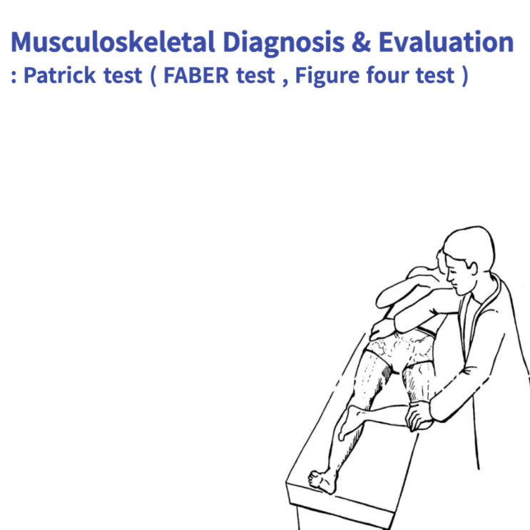 Patrick test ( FABER test , Figure four test ) : 페트릭 테스트 - 엉치엉덩관절평가 ,엉덩 ...