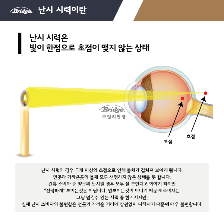 난시렌즈 소비자의 시력을 위한 난시렌즈를 통해 시력 불편함과 어지럼을 해결하세요 브릿지안경 난시 전용 렌즈 네이버 블로그