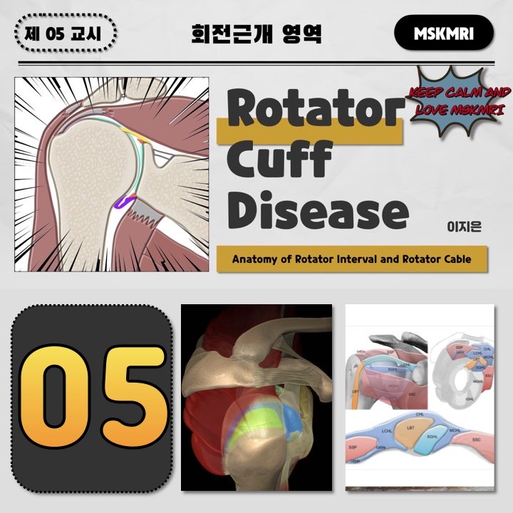 [Rotator cuff Anatomy 05] Anatomy of Rotator Interval and Rotator Cable ...