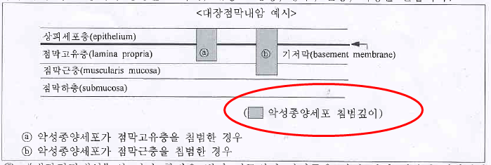 C20 직장의 악성 신생물 진단비 처리가 되지 않은 이유 네이버 블로그