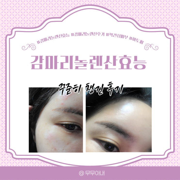 감마리놀렌산효능 악건성피부 피부건조 도움됐어요 네이버 블로그