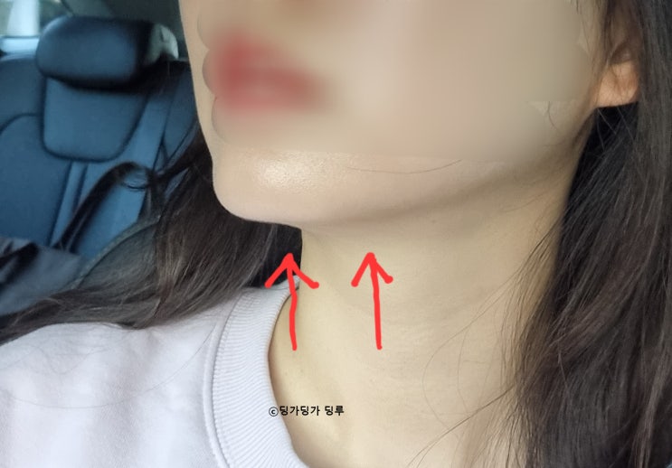 창원 피부관리 끌리메 작은얼굴관리 받고 온 후기 할인권 네이버 블로그