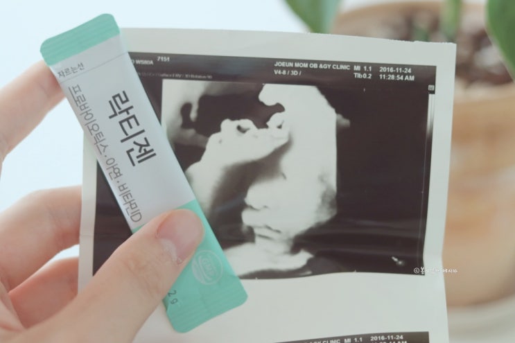 임산부유산균 아이도 먹을 수 있는 프로바이오틱스 유산균 네이버 블로그