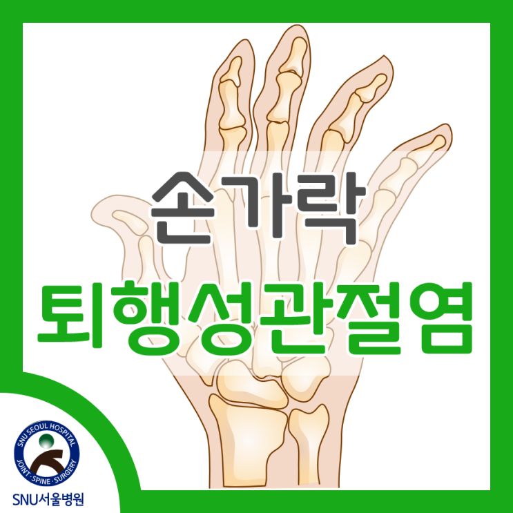 강서정형외과 손가락에도 퇴행성관절염이 발생한다 네이버 블로그