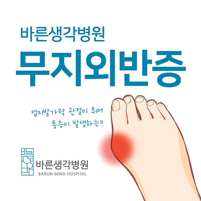 대전관절병원 세종정형외과 발 모양 변형으로 통증과 불편을 초래하는 무지외반증 네이버 블로그
