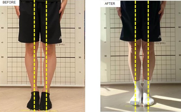 사직동 필라테스 맨즈필라테스 사직동 메디앤컬필라테스에서 자세교정하고 있어요 : 네이버 블로그