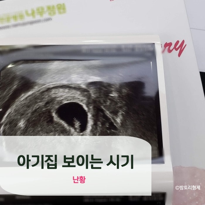 아기집 보이는 시기크기난황 W임신 5주차 증상 네이버 블로그