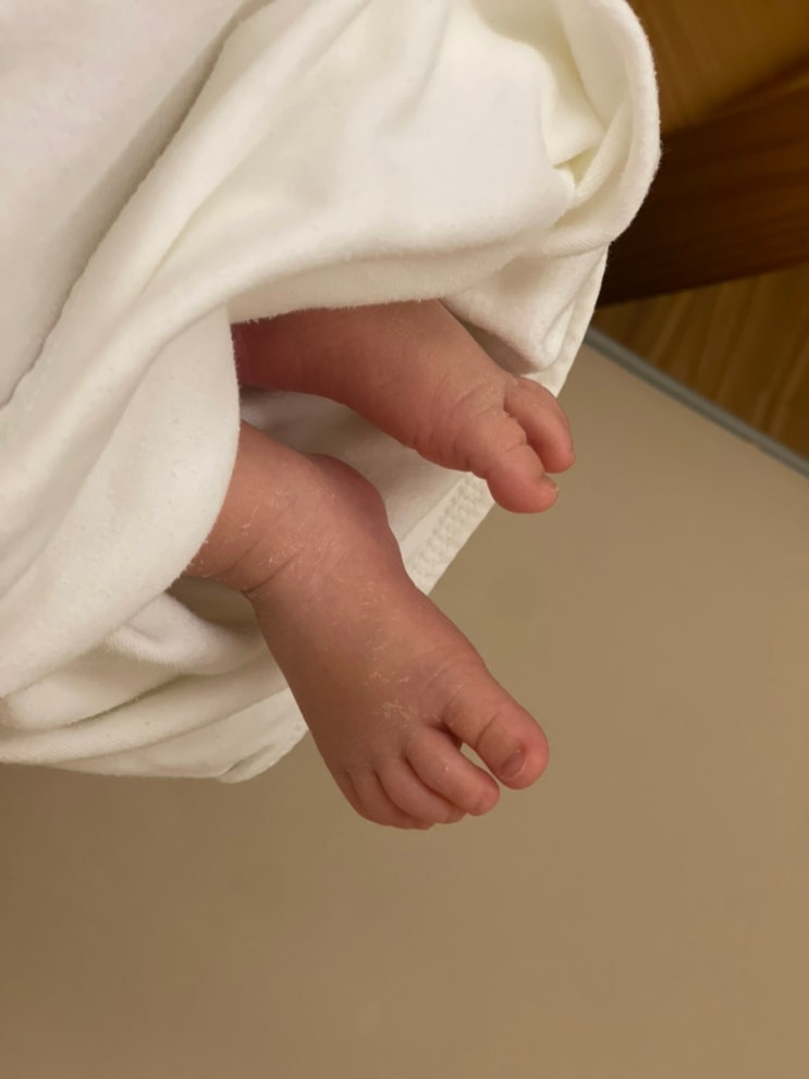 출산 임산부졸업 인정병원 유도분만 응급제왕절개 회복 후기 네이버 블로그