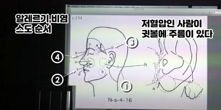 18. 2번. 알레르기 비염 딸기코 아토피 KSNS 스본 스도 방법 : 네이버 블로그