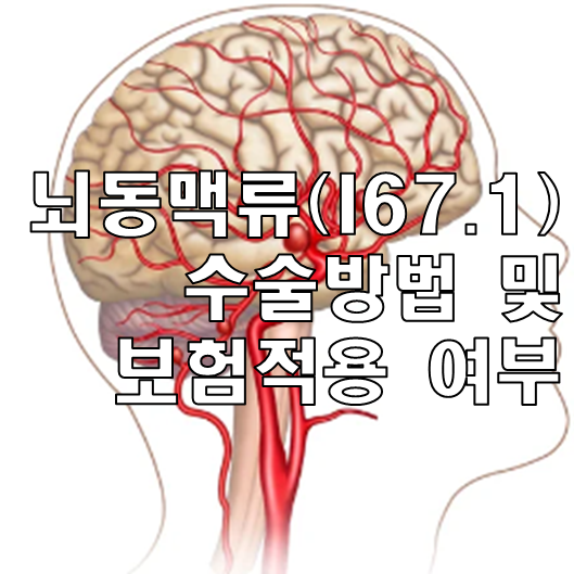 뇌동맥류(I67.1)수술방법 과 보험적용 : 네이버 블로그