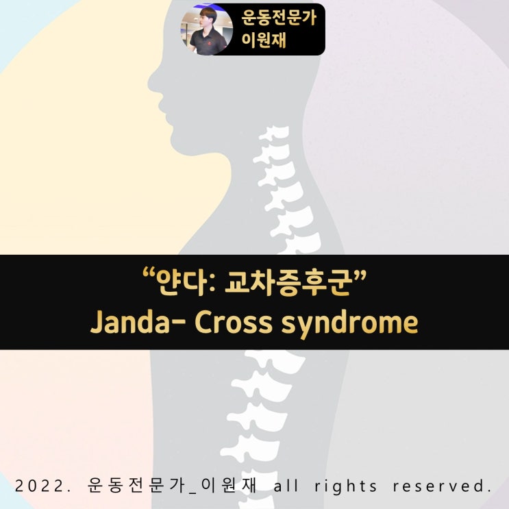 “얀다: 교차증후군(Janda- Cross syndrome)" [운동전문가이원재] : 네이버 블로그