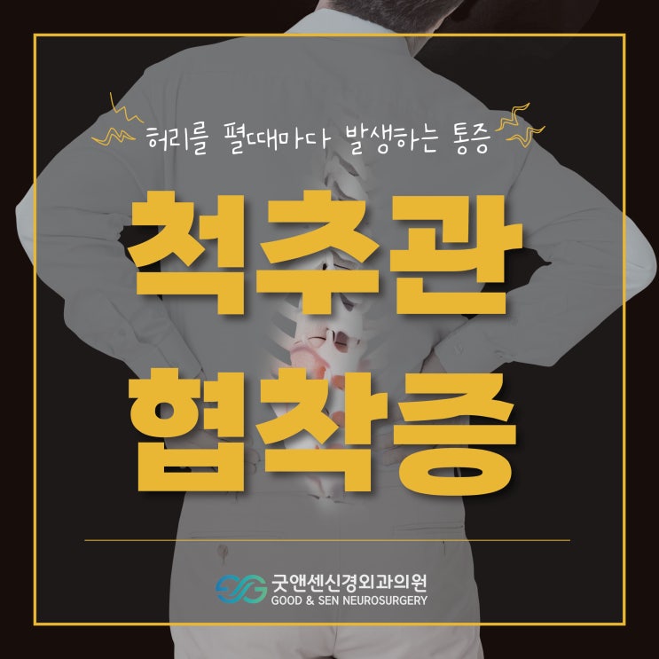 진주 굿앤센신경외과 허리를 펼 때마다 발생하는 척추 통증 척추관협착증 원인과 증상은 네이버 블로그