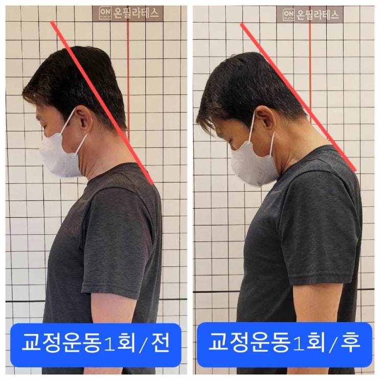 부산 60대 남성회원님 목 불편하셔서 찾아주셨어요 목교정 1회차센텀필라테스해운대필라테스부산체형교정온필라테스 네이버 블로그