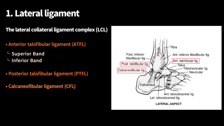외측 발목 인대 해부학 / 전거비인대(ATFL), 종비인대(CFL), 후거비인대(PTFL), ankle sprain(발목염좌 ...