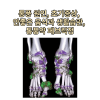 통풍 원인 초기증상 안좋은 음식과 생활습관 통풍약 페브릭정 네이버 블로그