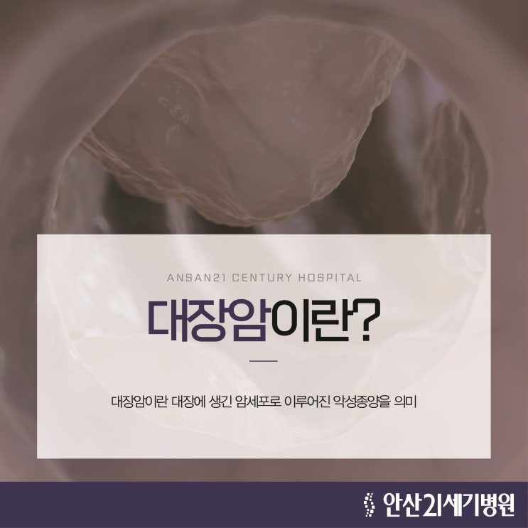 [안산21세기병원] 내과센터 - 대장암, 대장에 발생한 악성종양! 내시경 검사로 충분히 예방 가능합니다! : 네이버 블로그