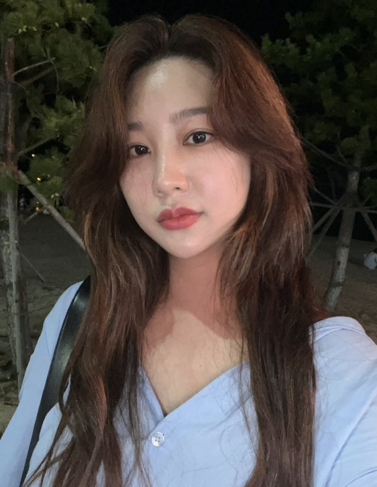 쌍꺼풀재수술 눈매교정 트임 후기 네이버 블로그