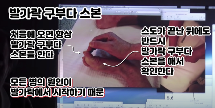 24. 1. 발, 고관절 통증 원인과 KSNS 스본 스도 원리 : 네이버 블로그