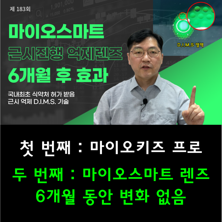 근시 관리 렌즈 마이오키즈 프로에서 근시 억제 마이오스마트 렌즈ㄴㅅㅎㅈ 네이버 블로그