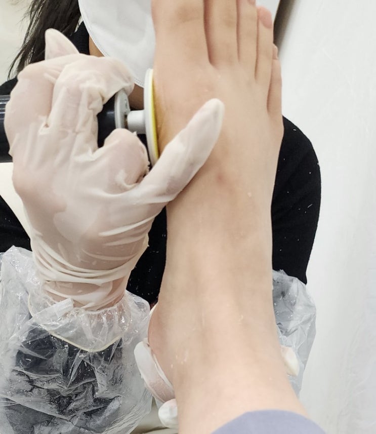 김해 패디플래닝 발각질관리 각질제거한 찐후기 봉황동 라블네일 네이버 블로그