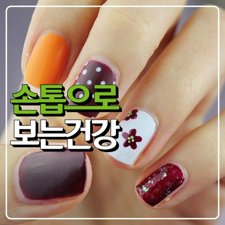 손톱울퉁불퉁 손톱멍과 색깔 모양으로 보는 건강손톱세로줄 흰반점 건선 흑색종 네이버 블로그