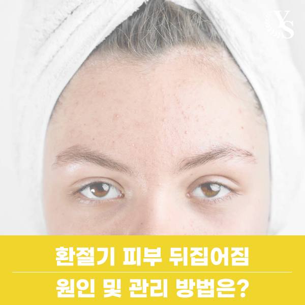 환절기 피부 뒤집어짐 원인 및 관리 방법은 네이버 블로그