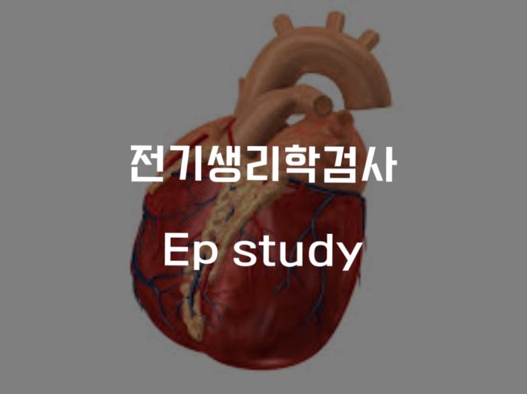 전기생리학 검사 EP STUDY :: 정의, 목적,간호, 준비사항 : 네이버 블로그