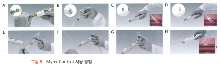혈관폐쇄기구의 사용방법 4th- Mynx Control vascular Closure device : 네이버 블로그
