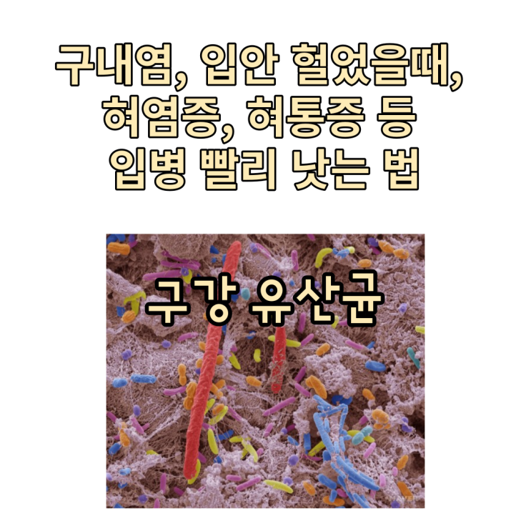 구내염 입안 헐었을때 혀염증 혀통증 등 입병 빨리 낫는 법구강 유산균 네이버 블로그