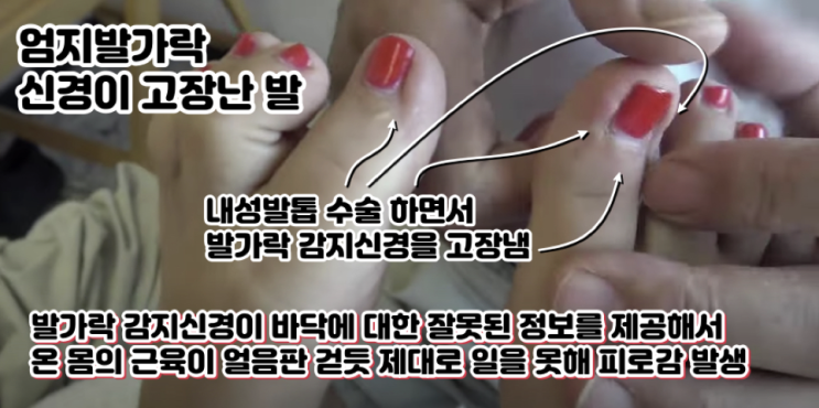 34. 온 몸 관절 근육 통증과 피곤증 KSNS 스본 스도 : 네이버 블로그