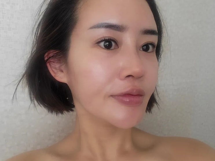 다사피부관리 장에스테에서 하이푸리프팅 네이버 블로그