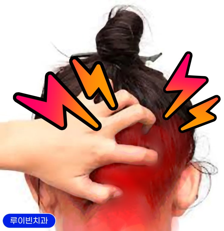 뒷골두통 찌릿 머리가아파요 네이버 블로그