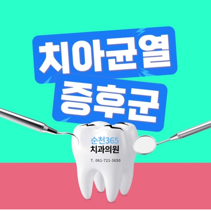 찌릿찌릿 치아균열증의 원인 증상과 치료법에 대해 알아보아요 네이버 블로그
