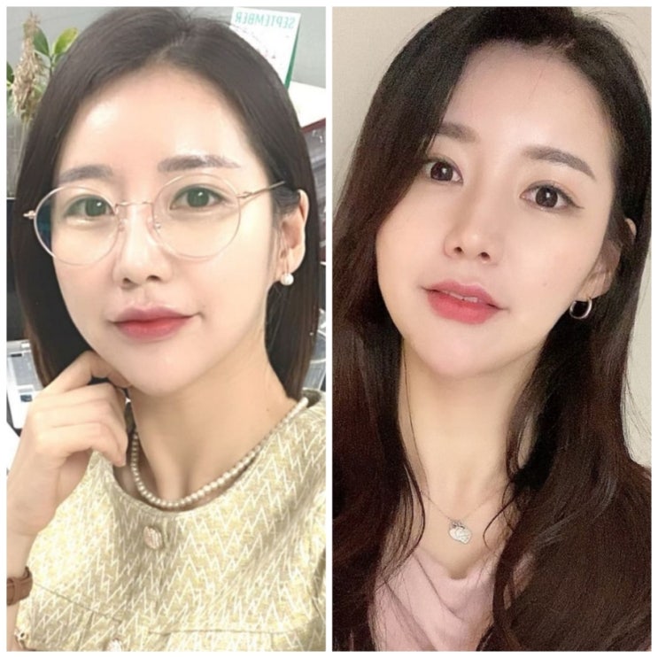 Jtbc 결혼에진심 결방이유 촬영지 히든데이트 ⭕️지주희 인스타 김동욱 직업 박서희 정윤비 치과의사 김광석 나이 병원 위치